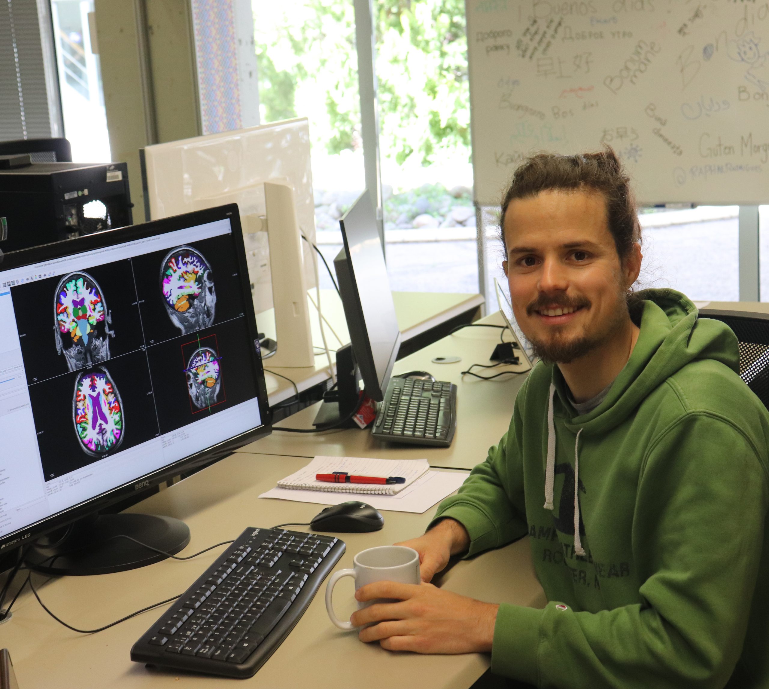 Jorney of post-doc Adrià Casamitjana: from signal processing to medical image analysis - Vicorob